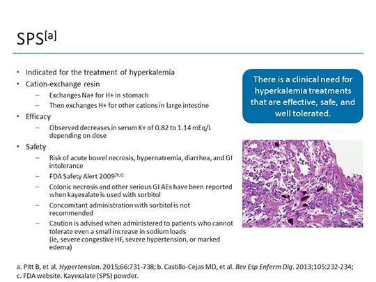 Hyperkalemia in the Hospital: Special Considerations and Novel ...