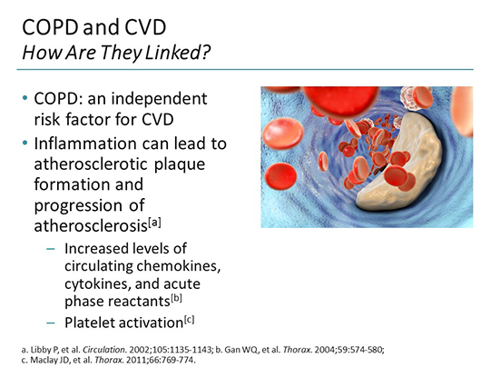 Optimizing Outcomes in Patients With COPD and Cardiovascular Comorbidities