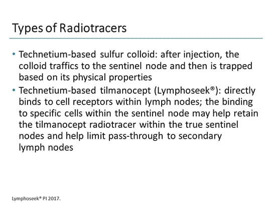 Best Practices in Lymph Node Mapping and Localization