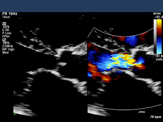 Echo Case: Four of a Kind