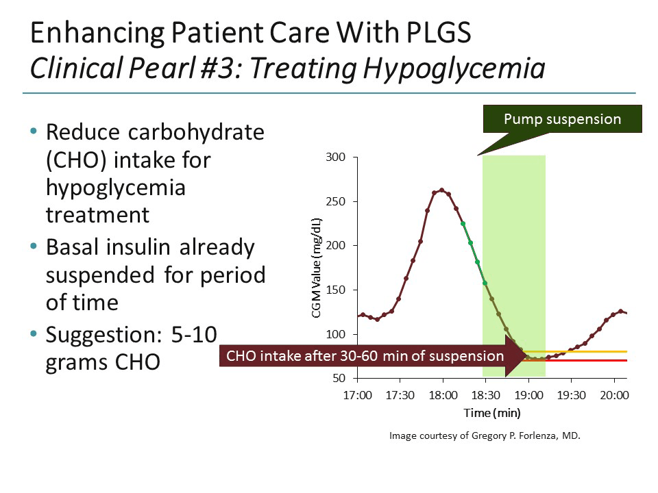 Predictive Low Glucose Suspend (PLGS): Future of Diabetes Management ...