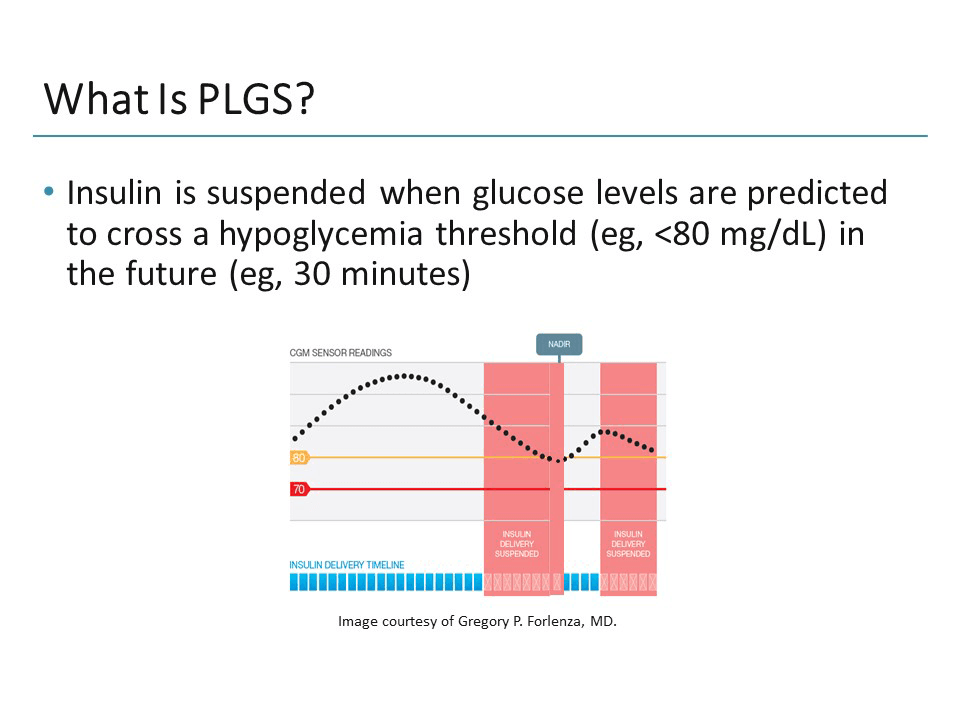 Predictive Low Glucose Suspend (PLGS): Future of Diabetes Management ...