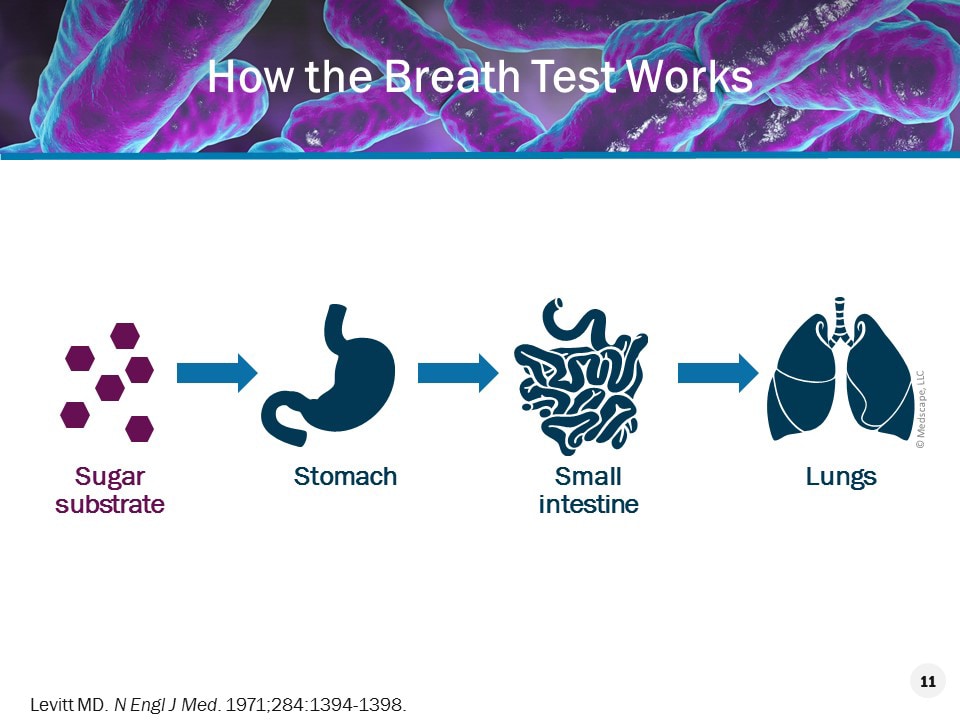 Targeting the Microbiome in GI Conditions: Hope or Hype?