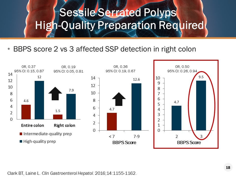 Optimizing Colonoscopy Outcomes Through Quality Bowel Prep (Transcript)