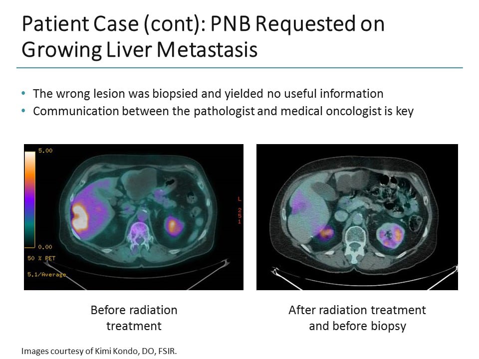 Optimizing Characterization of NSCLC Through Specialty Collaboration ...