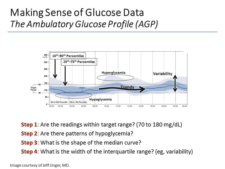 Hypoglycemia Reduction Using the Newest CGM Technology