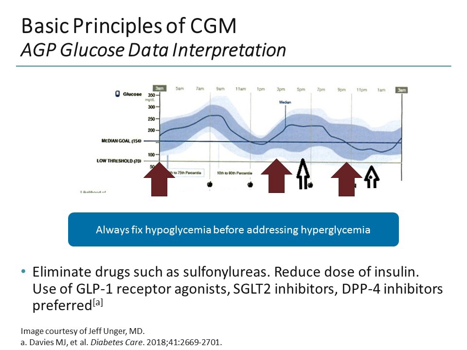 Hypoglycemia Reduction Using the Newest CGM Technology