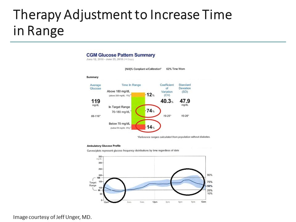 Hypoglycemia Reduction Using the Newest CGM Technology