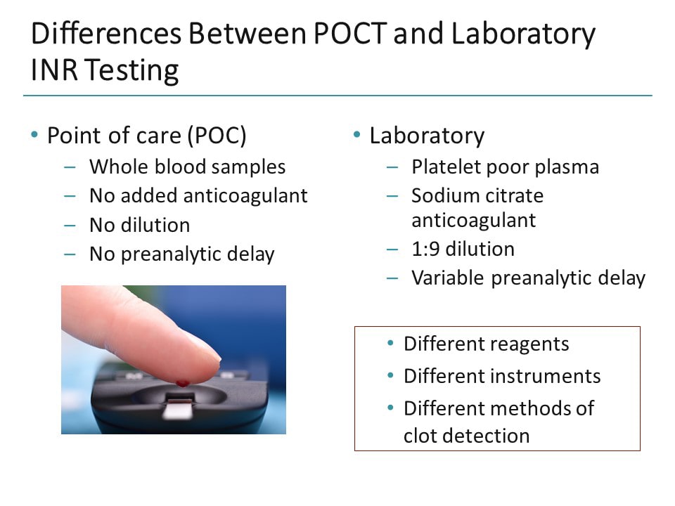 Point-of-Care vs Laboratory INR Testing to Optimize Anticoagulation ...