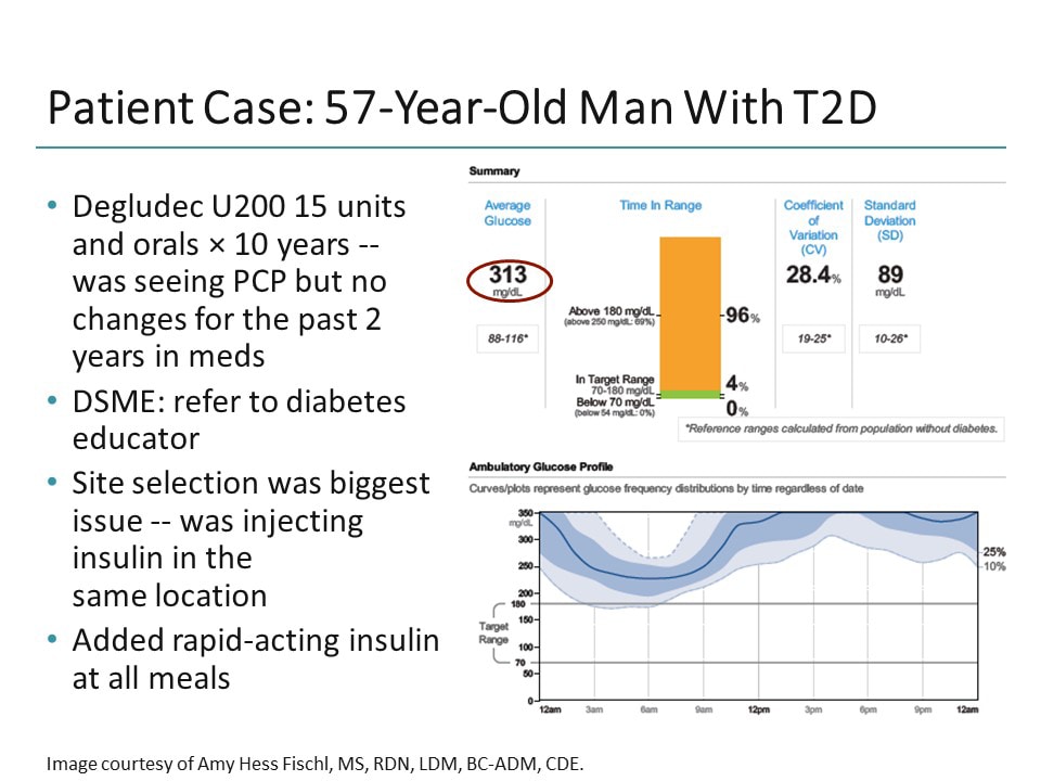 The Diabetes Educator's Role in Modern T2D Management: Utilizing CGM ...