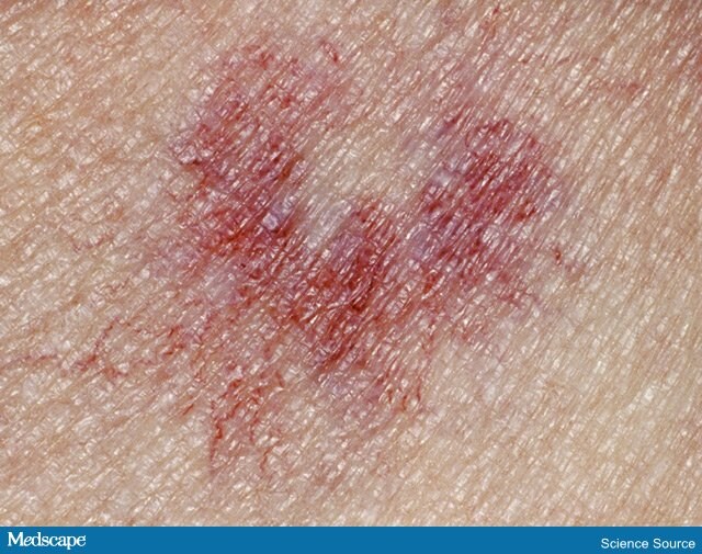 A 66-Year-Old Man Who Heard His Deceased Spouse's Voice - Page 2