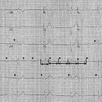 ECG Challenge: 'I Feel Like I'm Going to Pass Out' - Page 2