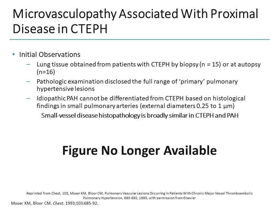 Clinical Comparisons in CTEPH: Assessing Trials, Updates and ...
