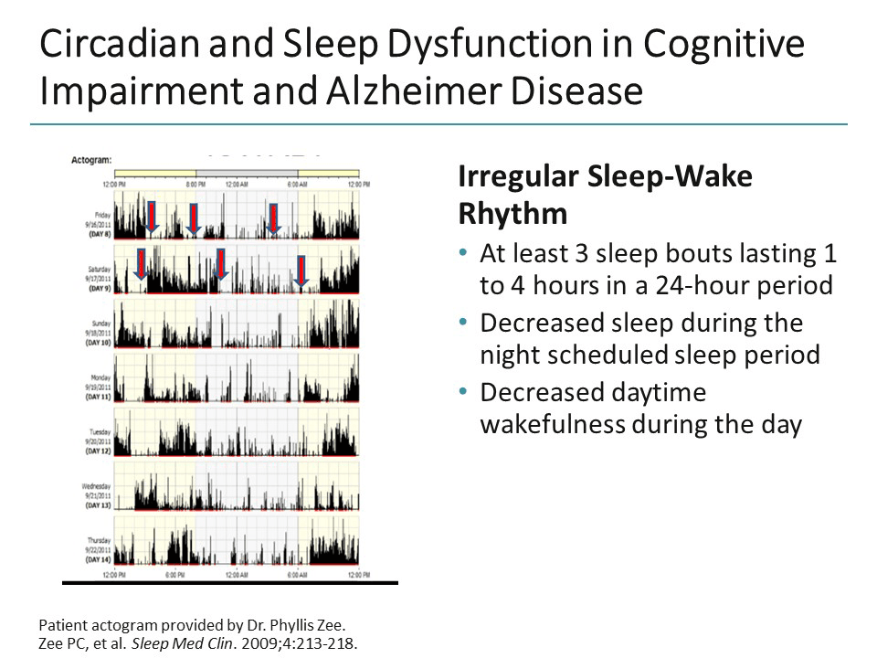 Understanding the Nature of Sleep and How it Changes With Age