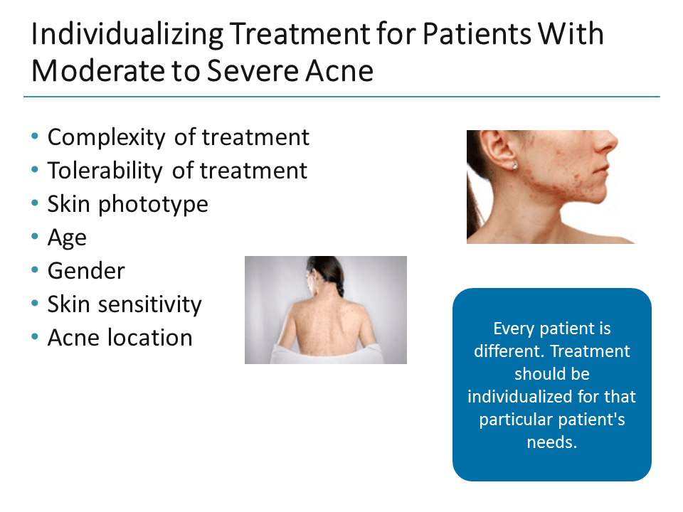 The Acne Landscape Is Evolving: Here's What You Need to Know