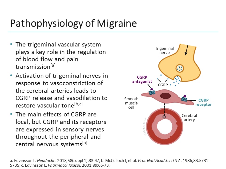 A Closer Look: Focus on Anti-CGRP for Migraine Prevention (Transcript)