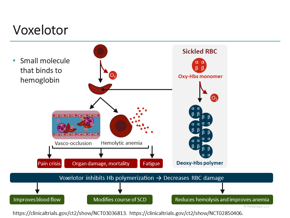 Updates on Sickle Cell Disease