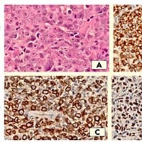 The 2018 Update of the WHO-EORTC Classification for Primary Cutaneous ...