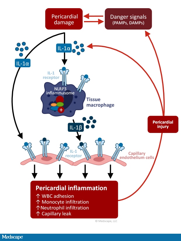 What Is New in Recurrent Pericarditis? Emerging Evidence and ...
