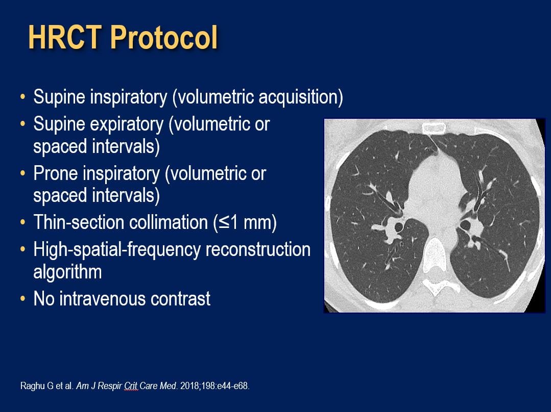 Diagnosing and Assessing IPF: Role of the Radiologist