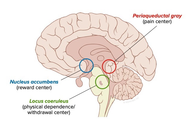 Pain Management and Opioids: Balancing Risks and Benefits