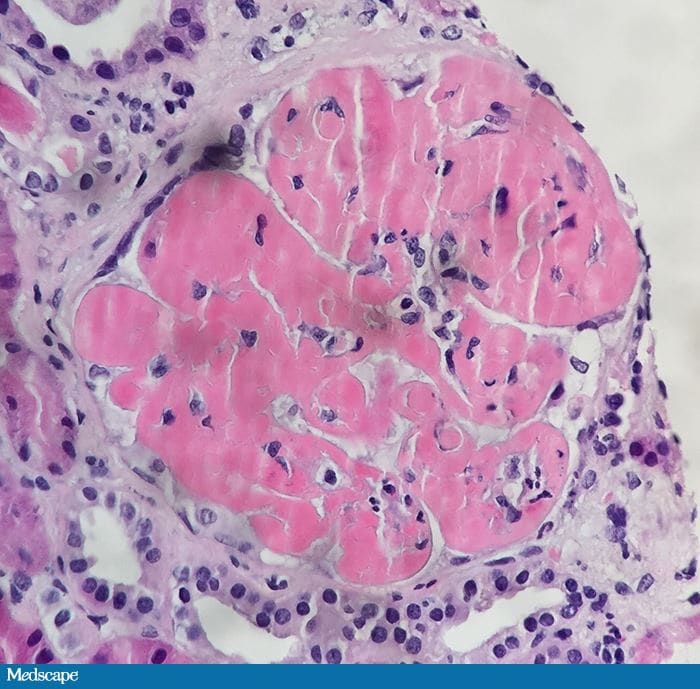 A 58-Year-Old Man With a Rash and Elevated Creatinine Levels - Page 4
