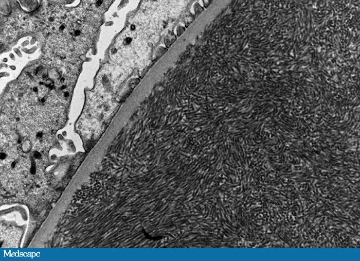 A 58-Year-Old Man With a Rash and Elevated Creatinine Levels - Page 2