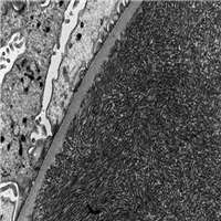 A 58-Year-Old Man With a Rash and Elevated Creatinine Levels - Page 2