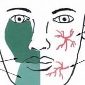Skill Checkup: Complex Lip Laceration