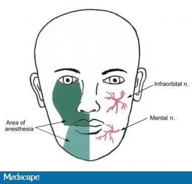 Skill Checkup: Complex Lip Laceration