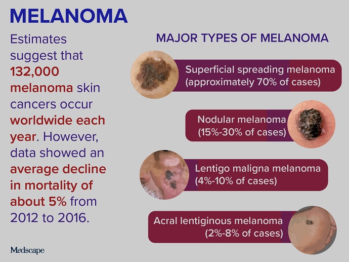 Nodular Malignant Melanoma