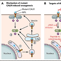 Mutant Calreticulin in Myeloproliferative Neoplasms