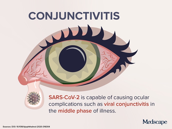 Trending Clinical Topic: Conjunctivitis