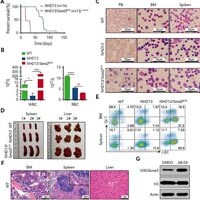 SETD2 Deficiency Accelerates MDS-Associated Leukemogenesis via S100a9 ...
