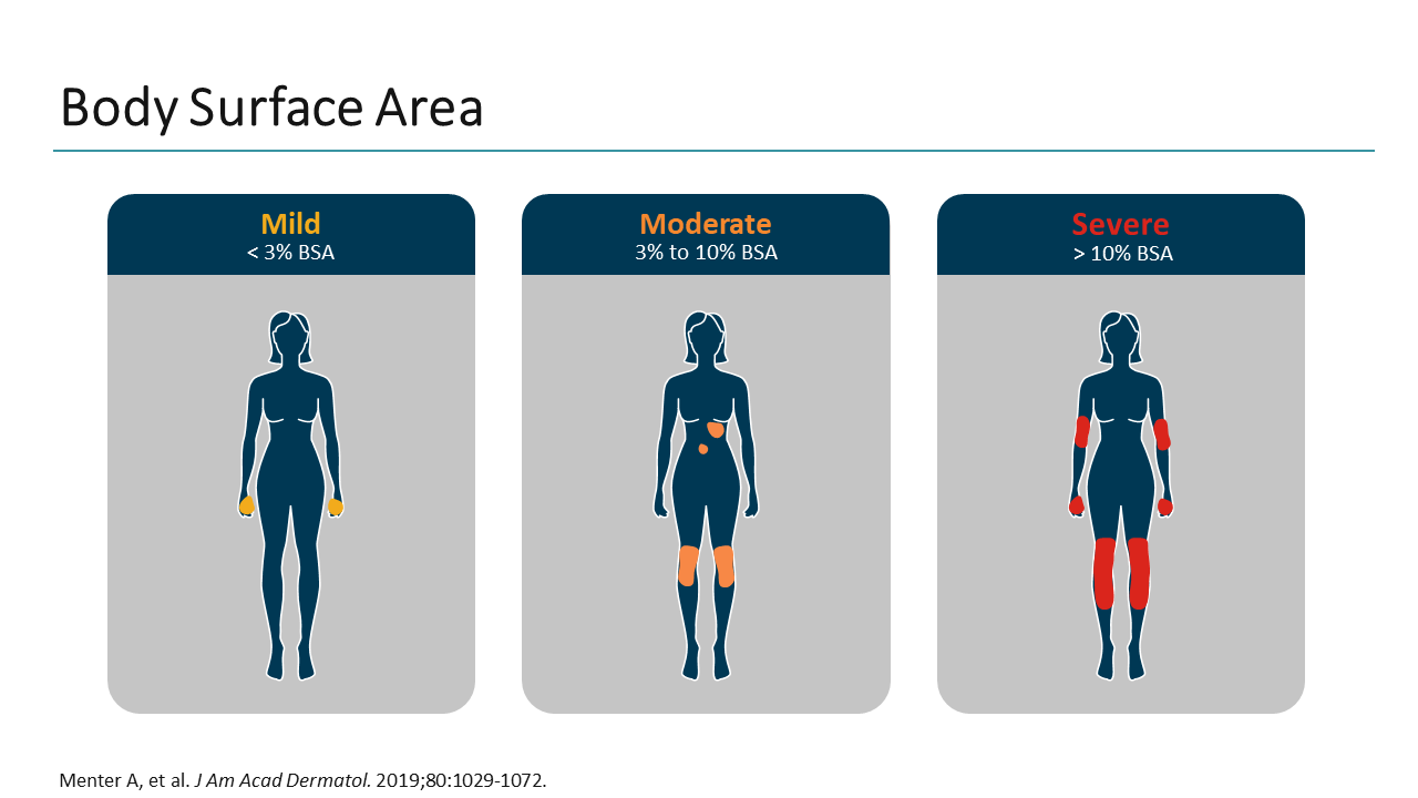 The Dermatology Medscape Clinic: Navigating Treat-to-Target in ...