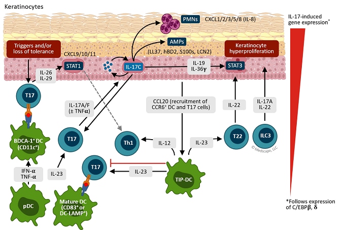 Translating New Psoriasis Guidelines Into Practice