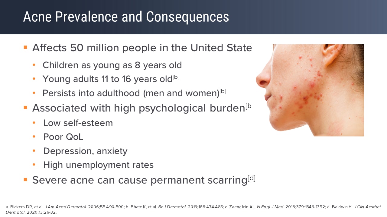 Acne: Conversations from the Clinic (Transcript)