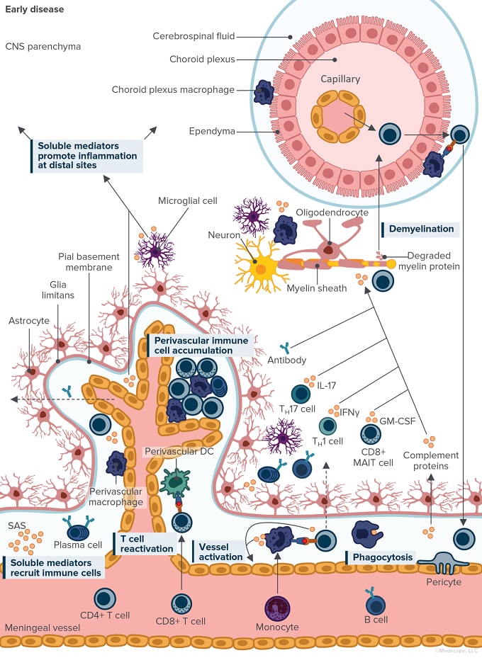 Bringing the Immune System to Life in Multiple Sclerosis: What Does ...