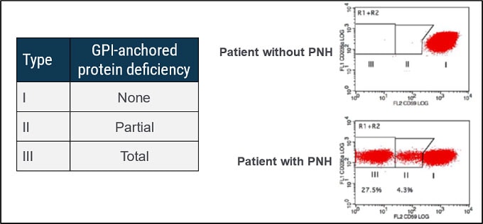 How Do You Stack Up? Optimizing Care for Patients With Paroxysmal ...
