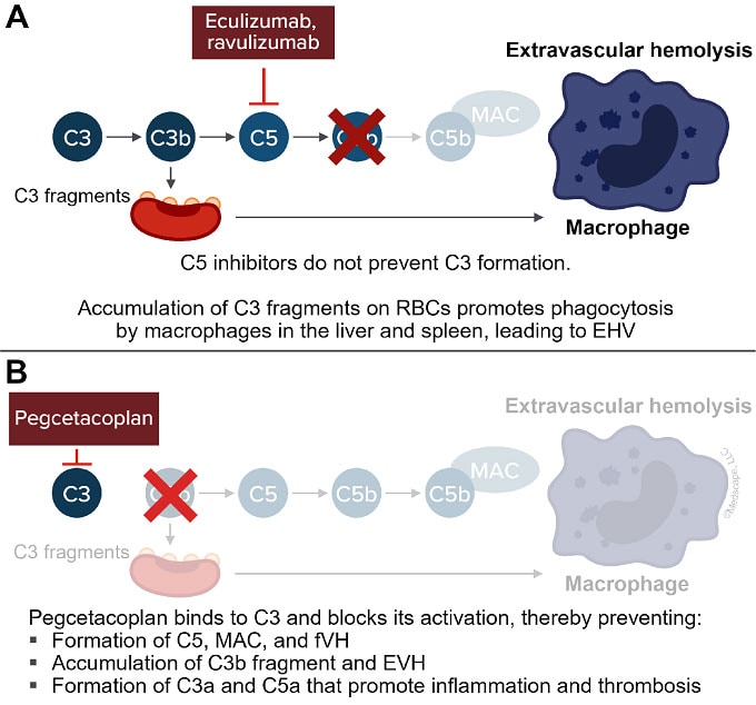 How Do You Stack Up? Optimizing Care for Patients With Paroxysmal ...