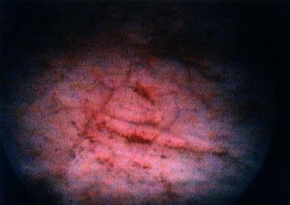 Seeking A Rational Approach to the Diagnosis and Treatment of ...