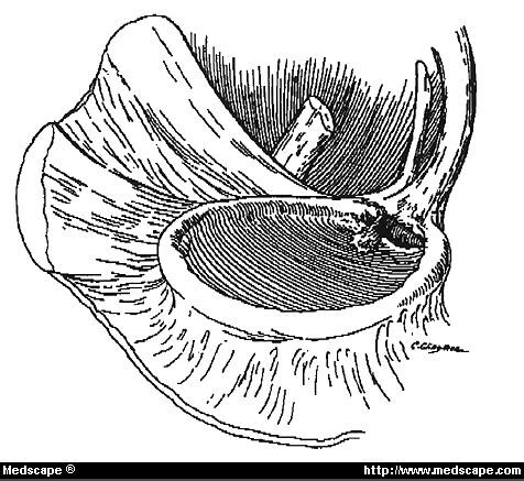 Sports Medicine Feature - The Recognition and Treatment of Superior ...