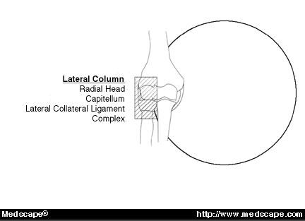 Restoring Elbow Stability After Fracture-Dislocation Part I: Elbow ...