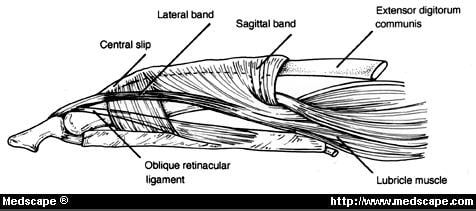 Late Reconstruction of Flexor and Extensor Tendon Injuries - Page 4