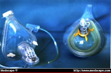 Mechanical Ventilation in Acute Respiratory Failure