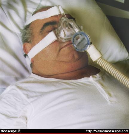 Mechanical Ventilation in Acute Respiratory Failure