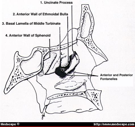 Sinusitis: A Head and Neck Surgeon's Perspective - Page 5