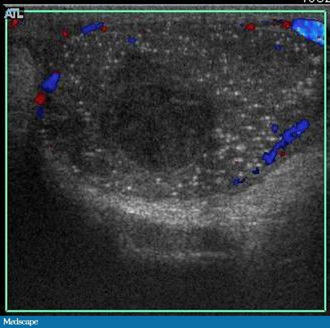 Der klinische Fall: Atemnot und Flankenschmerz bei einem 24-Jährigen ...