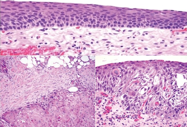 Diashow: Dysurie – die wichtigsten Ursachen und Therapien im Überblick ...