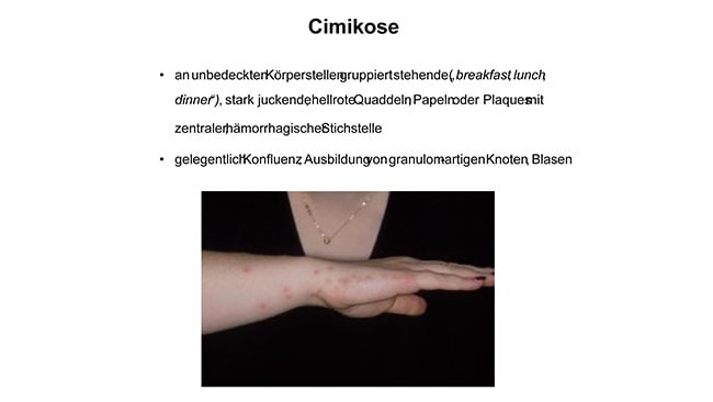 Verhasstes Reisesouvenir: Bettwanzen rechtzeitig erkennen